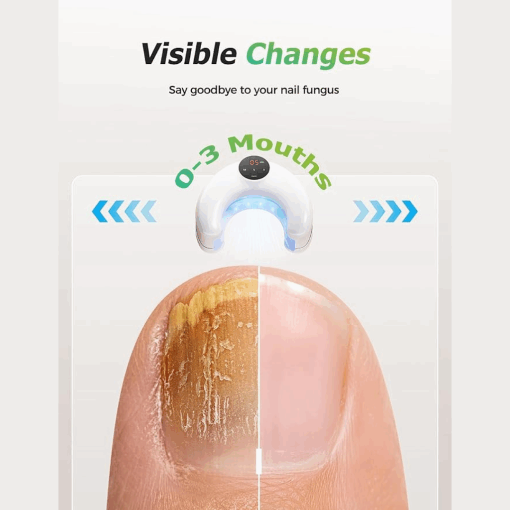 FungaBeam (Upgraded Version) - Official Retailer